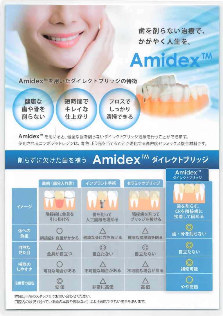 amidex導入しました-歯を削らずに欠けた歯を補う- | │守口市の歯医者│まつむら歯科クリニック│予防・審美・インプラント